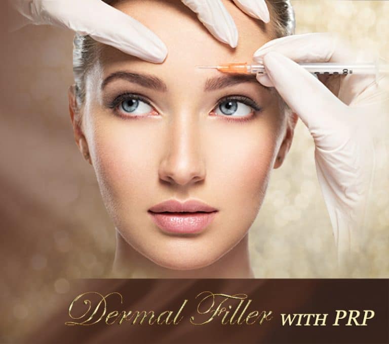 Dermal Fillers with PRP | London, Essex and Surrey