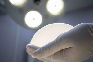 5 Things You Should Know About Capsular Contracture